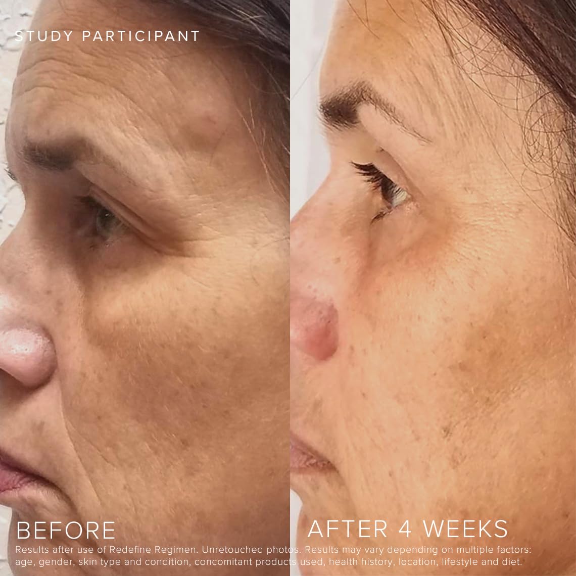 Rodan + Fields Redefine Regimen | Skincare Kit Includes Clay Cleanser, Toner, Triple Defense Cream, & Overnight Cream | Skin Care Gift Set for Women