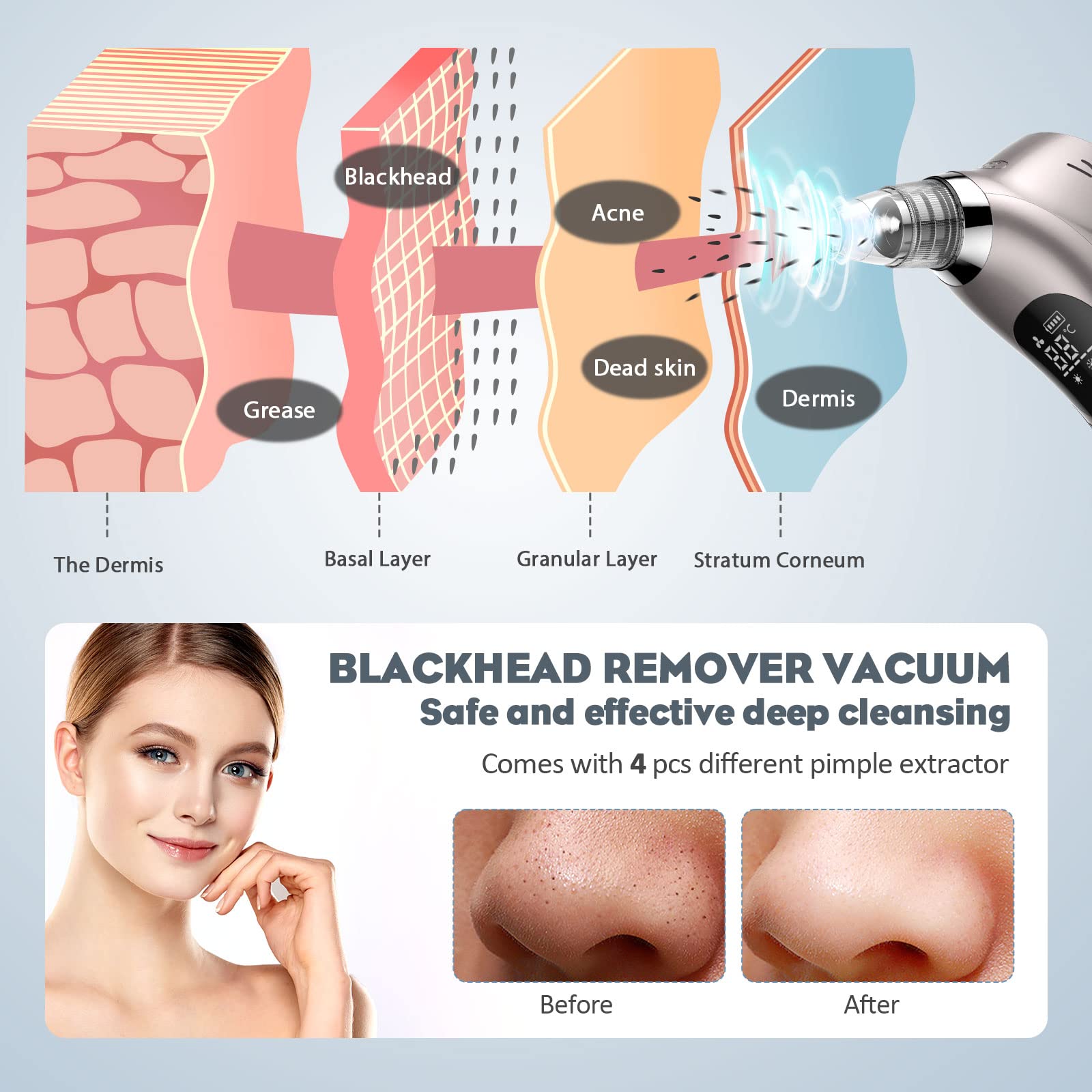 Blackhead Remover Pore Vacuum, Electric Pore Extractor with Hot & Cold Compress, 68kPa Facial Acne Comedone Whitehead Black Head Cleaning Tool Kit, 5 Suction Probes, USB Rechargeable Acne Cleaner