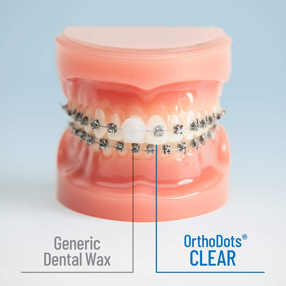 OrthoDots CLEAR β Moisture Activated Braces Wax Alternative for Pain Caused by Braces, Clear Aligner Trays, and Other Orthodontic Appliances. OrthoDots Stick Better and Stay on Longer than Dental Wax.
