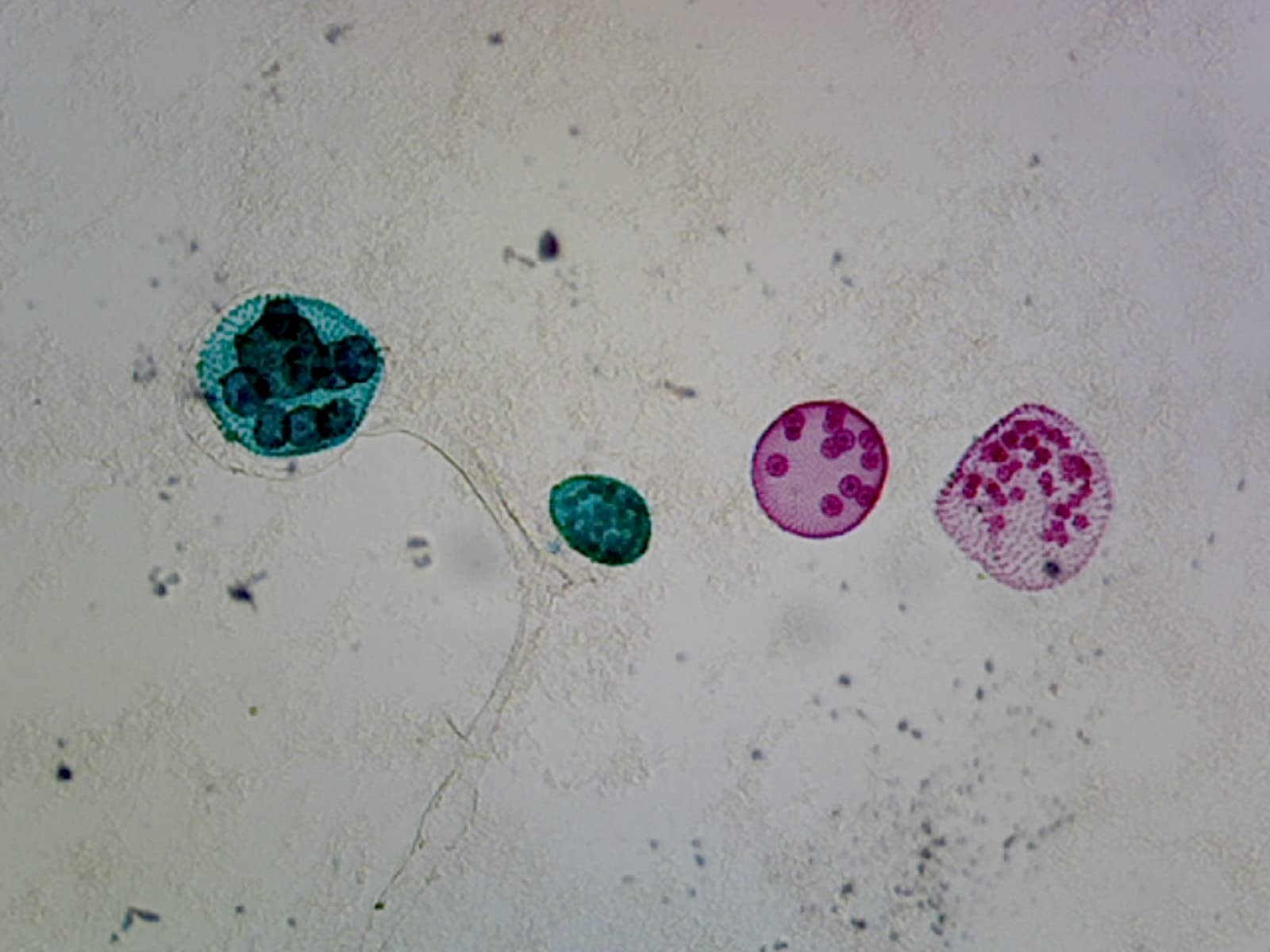 Volvox, Sexual Reproduction - Microscope Slide