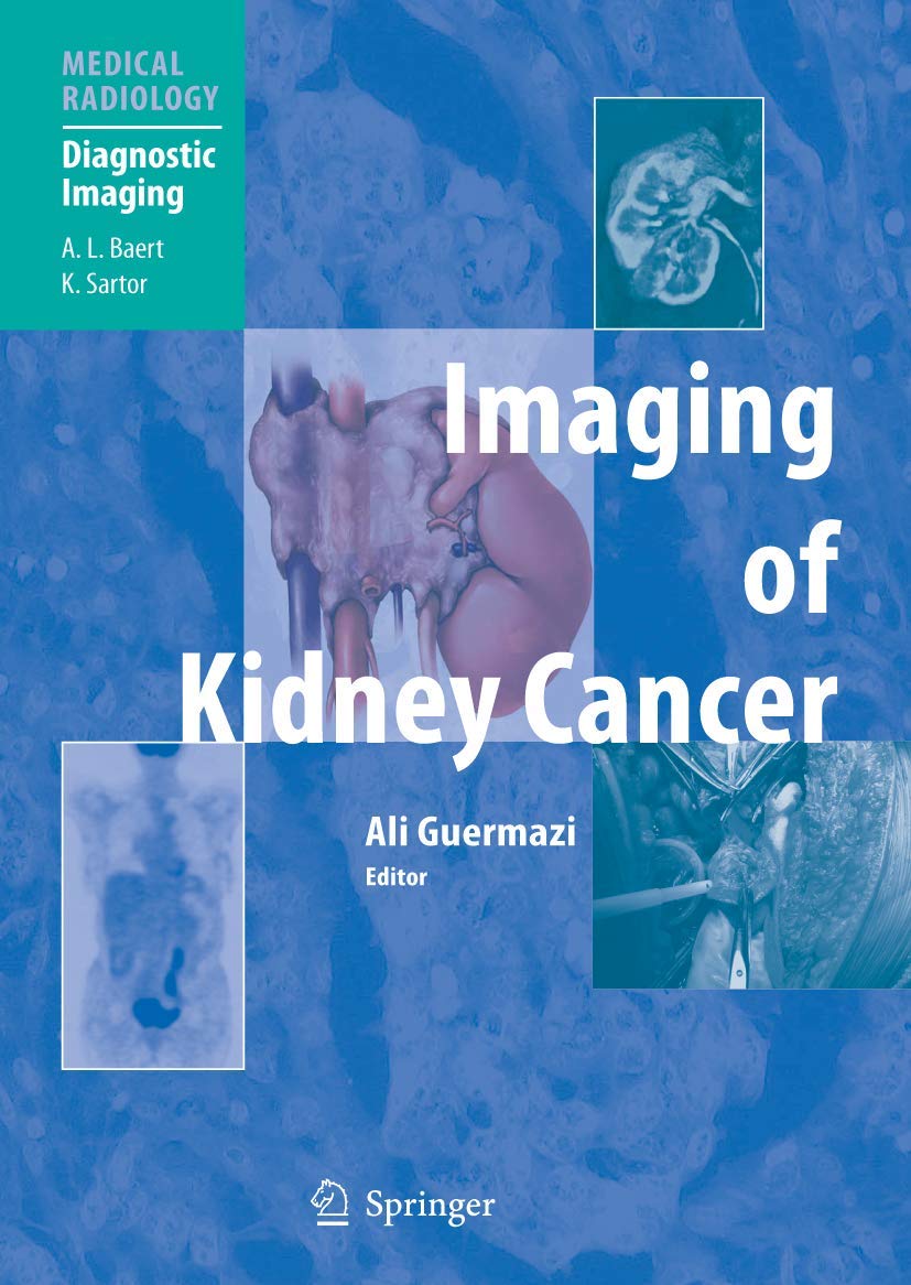 Imaging of Kidney Cancer (Diagnostic Imaging)