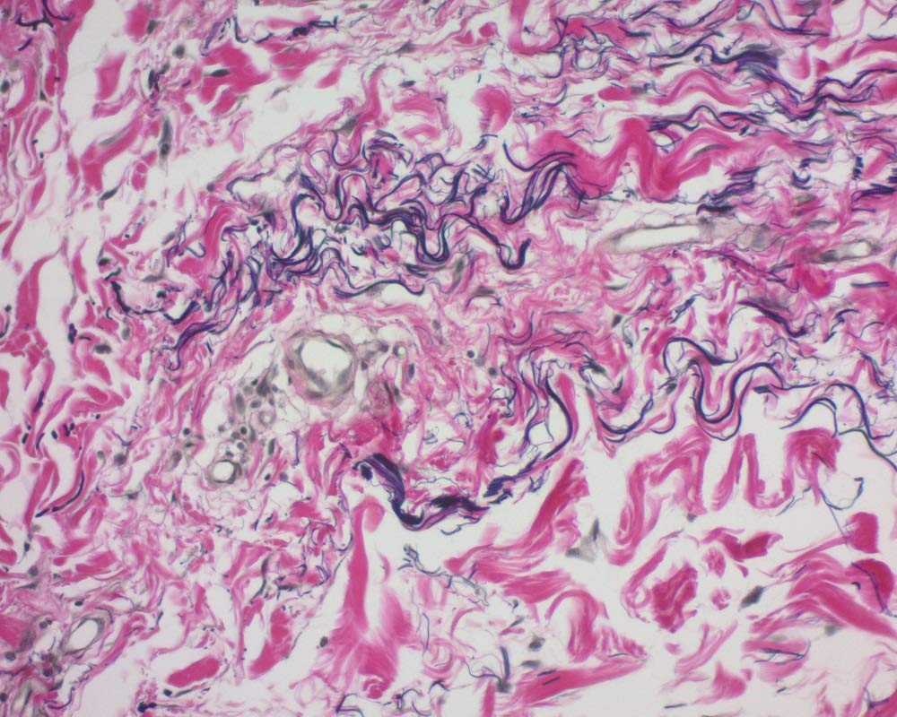 Elastic Tissue Stain Pack (Modified Verhoff's), 125ml