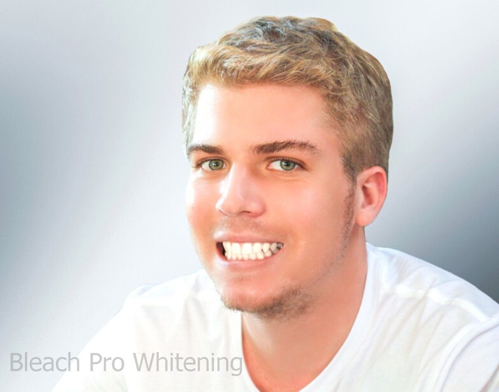 Teeth Whitening Gel 10% Carbamide Peroxide Tooth Bleaching Dispensers 10 pcs