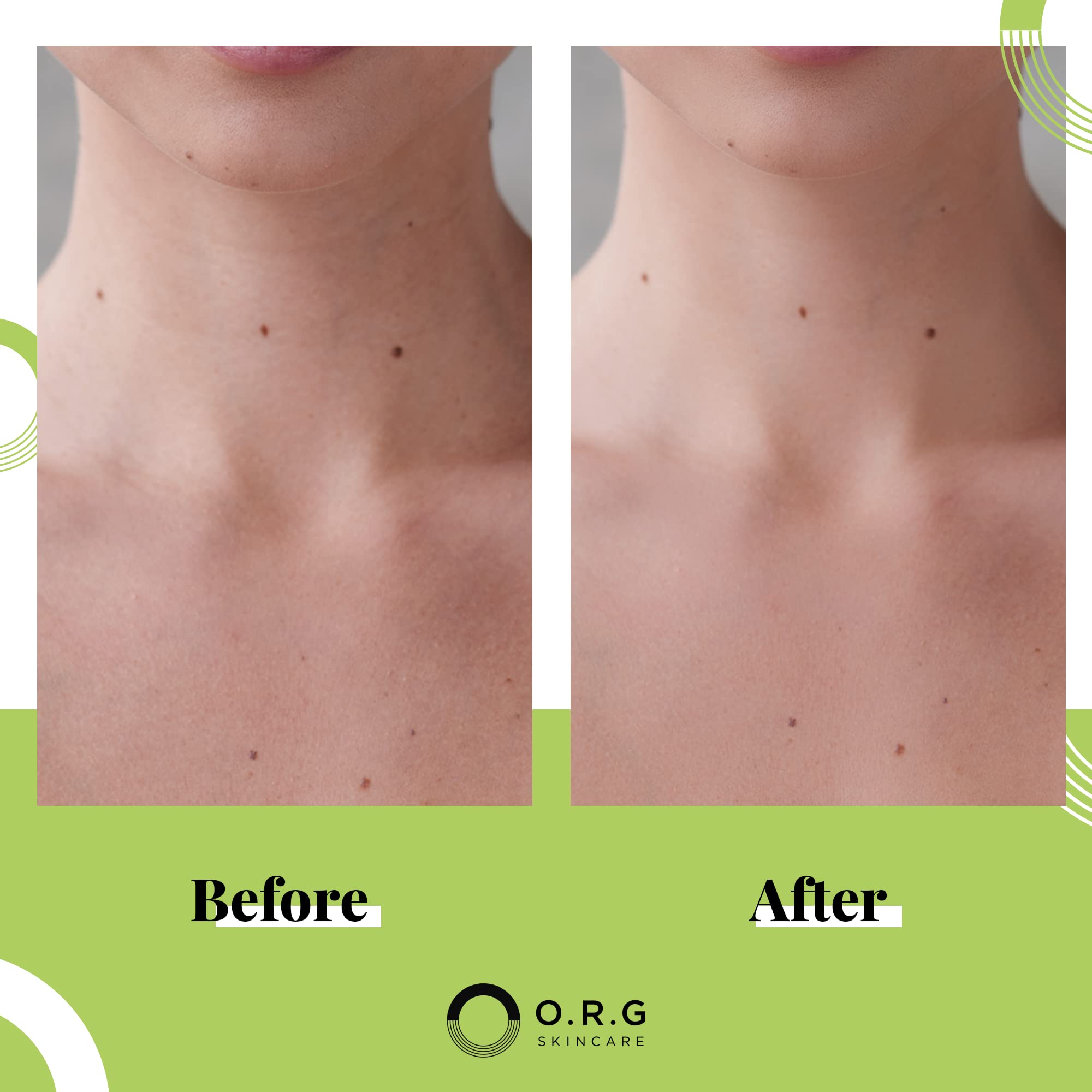 ORG Body Scrub Deep Gel Exfoliator for Glowing and Smooth Skin - Korean Exfoliating Peel Skincare - Natural Cruelty Free Formulation for Sensitive Skin 6oz