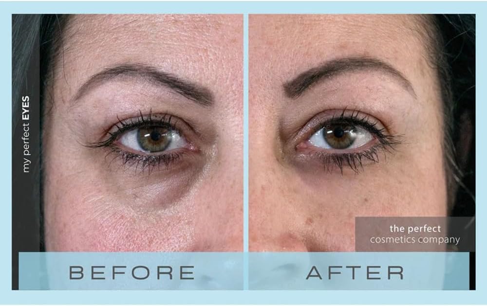 My Perfect Eyes 10ml, 100 Applications, Penny Lane, Instant Results, Clinically Proven, Anti-Ageing Serum UK Original Formula, Science-Backed Anti-Wrinkle Serum. As Seen on TV.