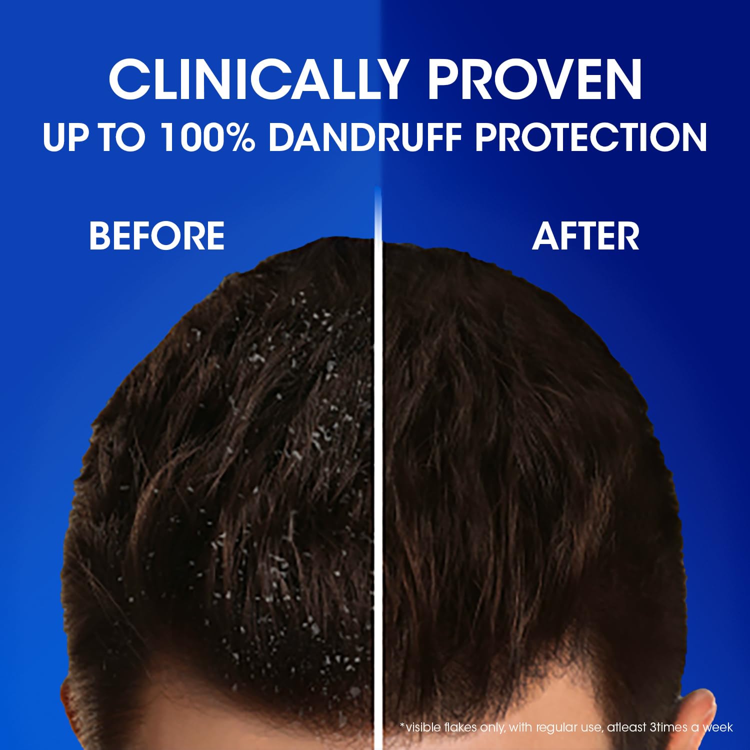 Head & Shoulders Anti Dandruff Cool Menthol Shampoo, 340ml