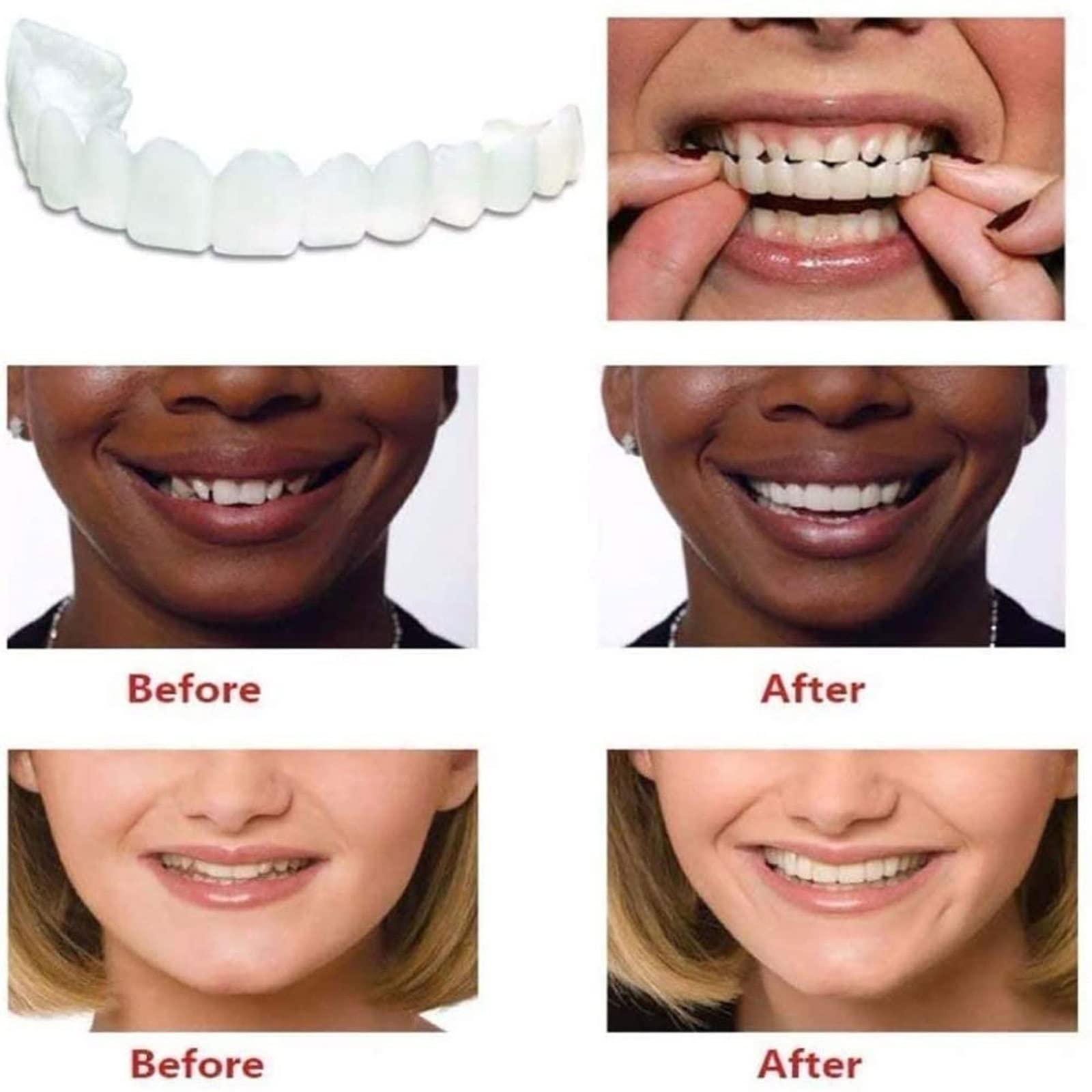 BEGUT 2 PCS Fake Teeth - for Women and Men, Dental Veneers for Temporary Tooth Repair Upper and Lower Jaw, Nature and Comfortable, Protect Your Teeth