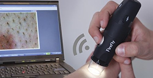 Firefly DE350 Wireless Polarizing Dermatoscope