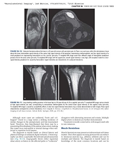 Musculoskeletal Imaging: Expert Radiology Series