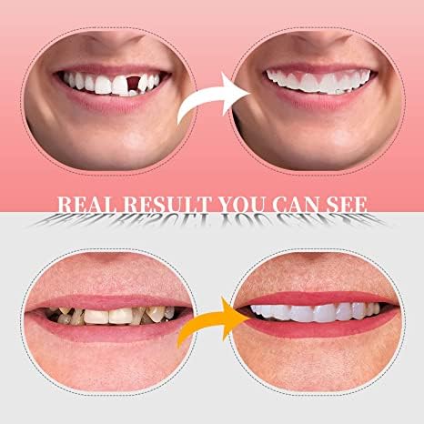 Fake Teeth Kit, 4 PCS Dentures Teeth for Women and Men, Dental Veneers for Temporary Teeth Restoration, Nature and Comfortable, Protect Your Teeth and Regain Confident Smile