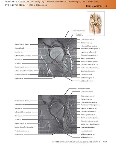 Netter's Correlative Imaging: Musculoskeletal Anatomy: with Online Access at www.NetterReference.com (Netter Clinical Science)