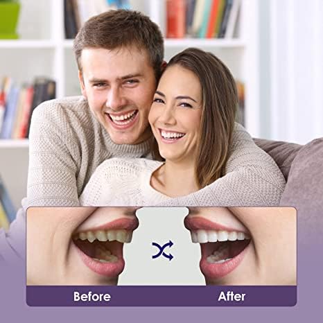 Fake Teeth Kit, 4 PCS Dentures Teeth for Women and Men, Dental Veneers for Temporary Teeth Restoration, Nature and Comfortable, Protect Your Teeth and Regain Confident Smile