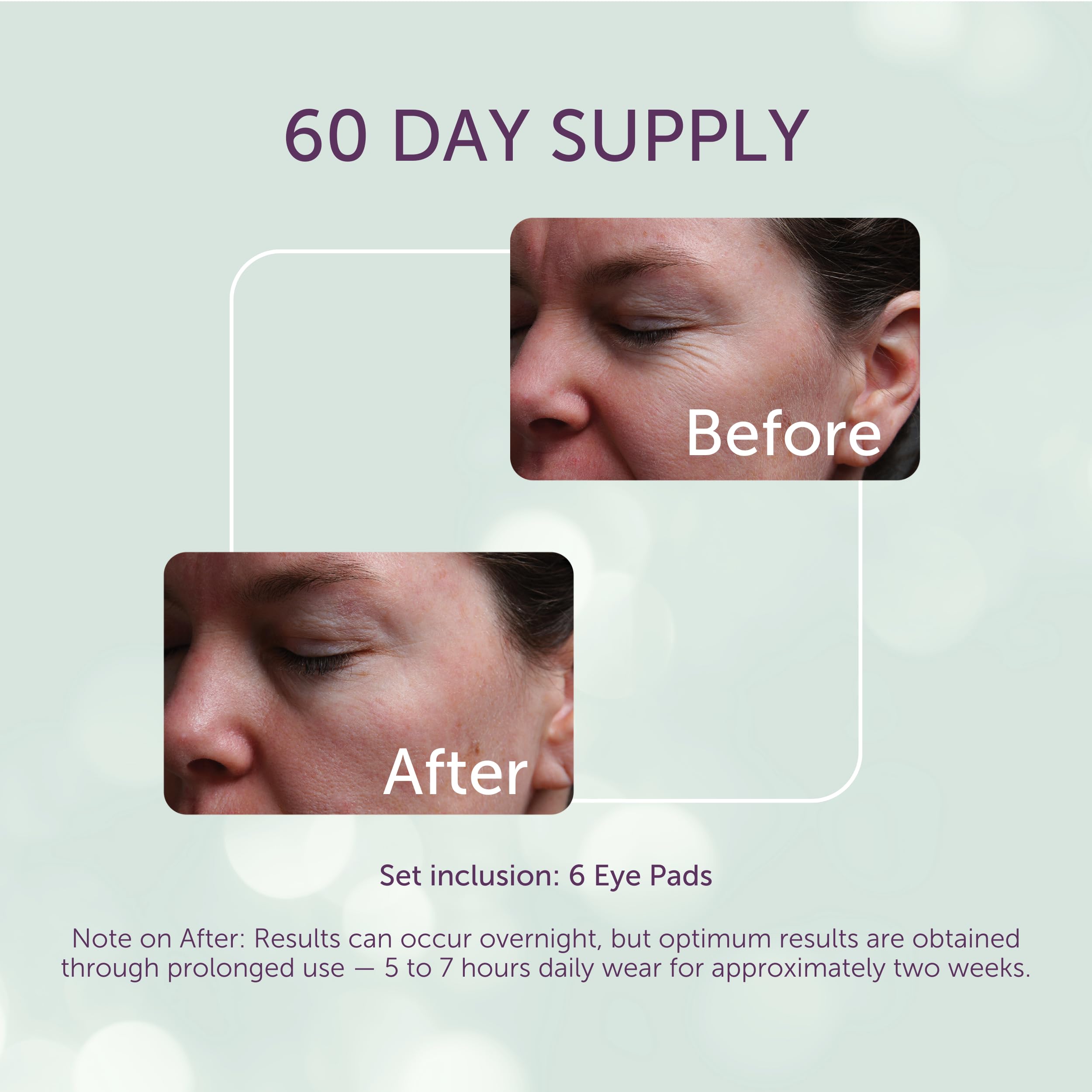 SilcSkin Silicone Eye Pads - Reusable Overnight Eye Patches, Medical-grade Silicone for Fine Lines, Crepey Skin, and Puffiness - 60 Day Supply