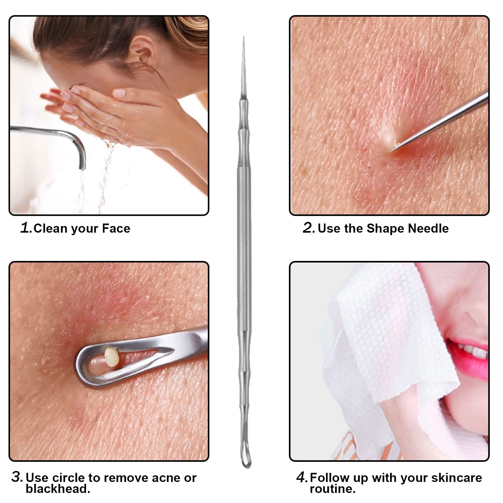Pointed Blackhead Removal, 2-in-1 Acne Extractor Tool - Stainless Steel Whitehead Remover for Face/Nose