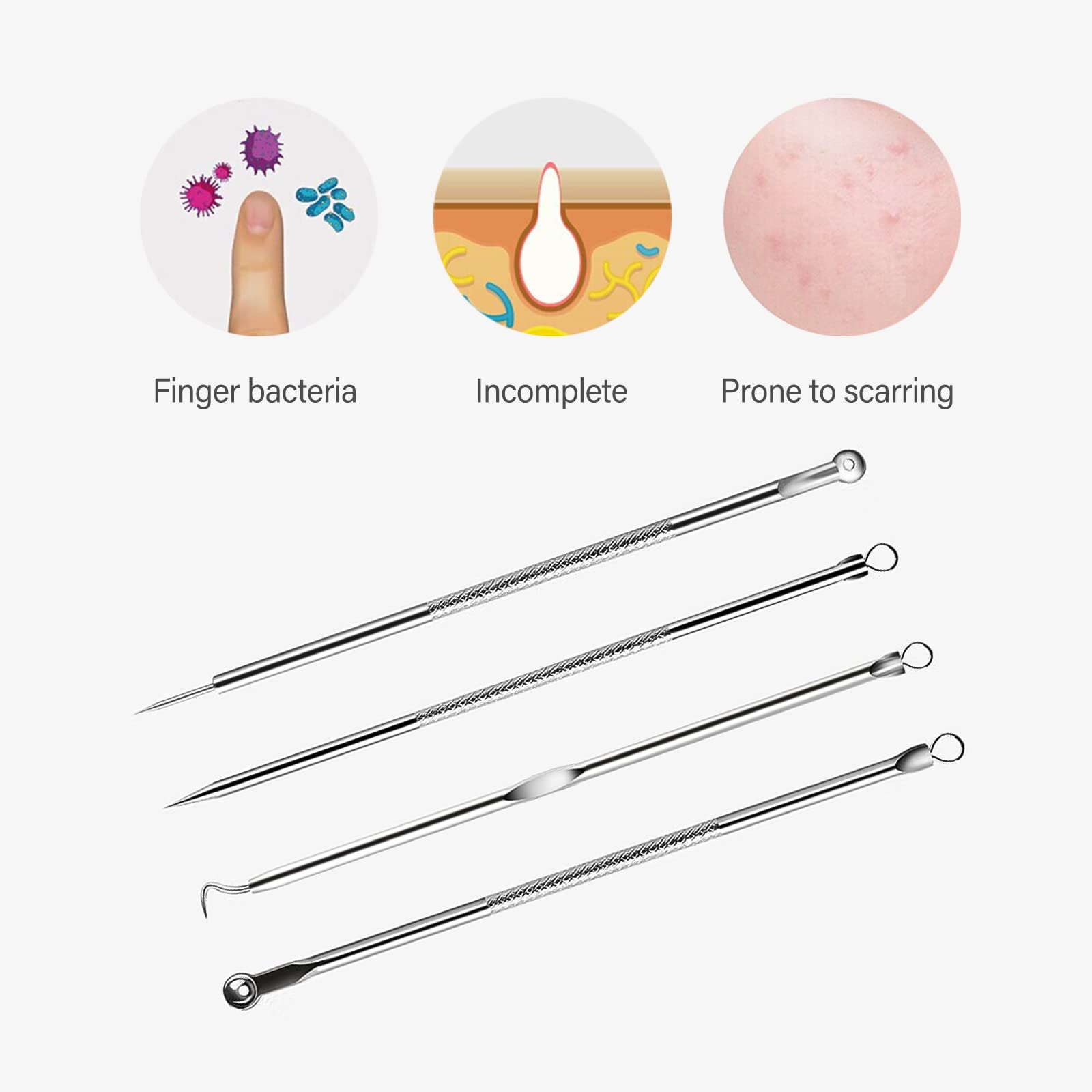 Blackhead Removal Tool, Pimple Popper Extractor Tool Kit, Used for Removing Blackheads, Acne, Comedone, Flaw White Heads on Nose and Face, Professional Stainless Steel Removal Tool.