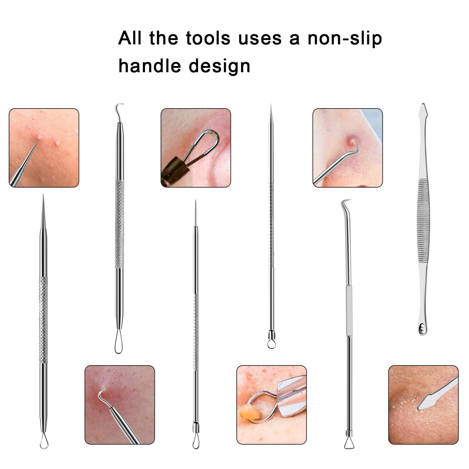 FIXBODY Blackhead & Splinter Remover Tools - Stainless Steel Professional Easily Cure Pimples Whiteheads Comedones Acne Zit Ingrown Hairs and Facial Impurities Bend Head Tweezer Surgical Kit (14 PCS)
