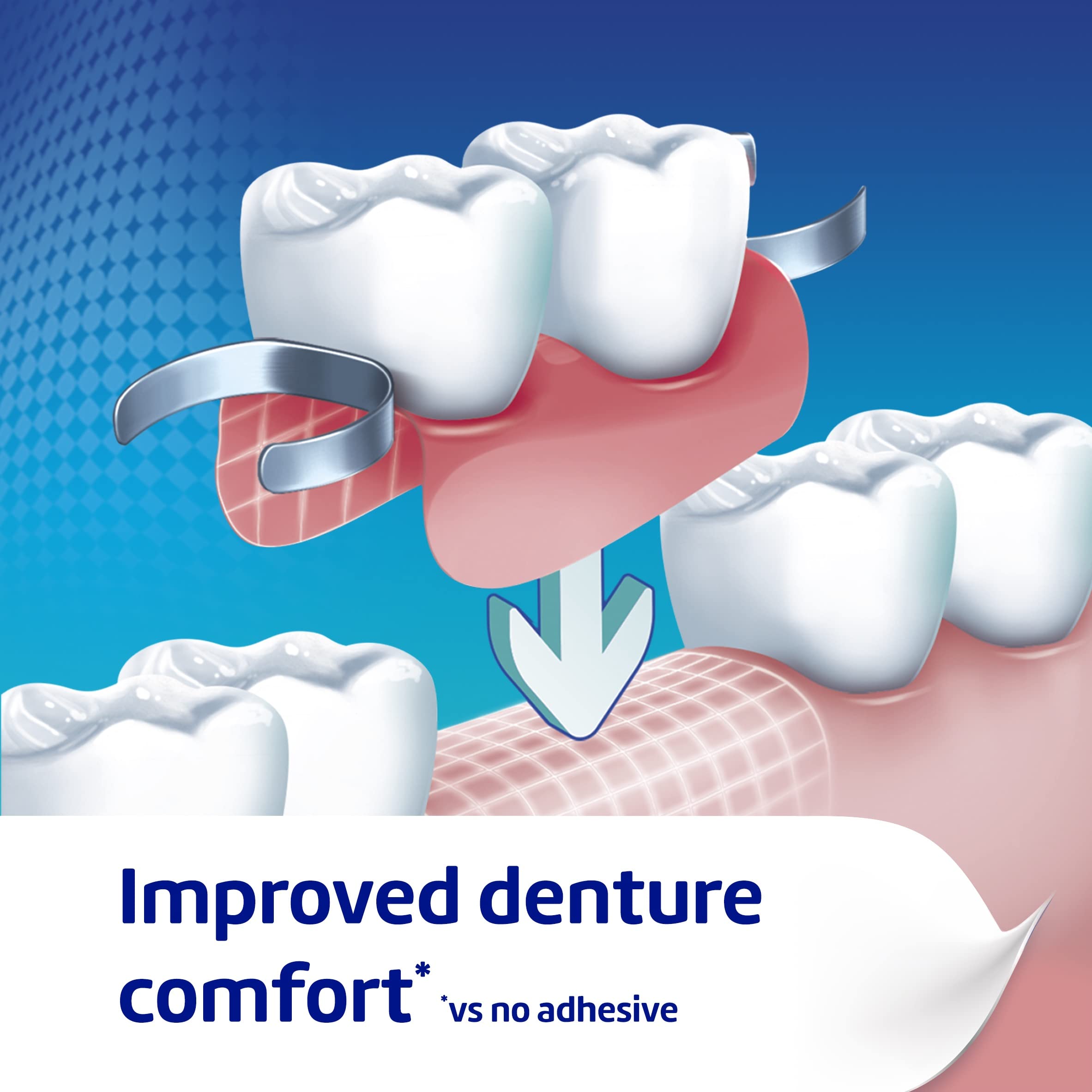 Poligrip Denture Adhesive Cream, False Teeth and Partials Fixative, Ultra, 40 g