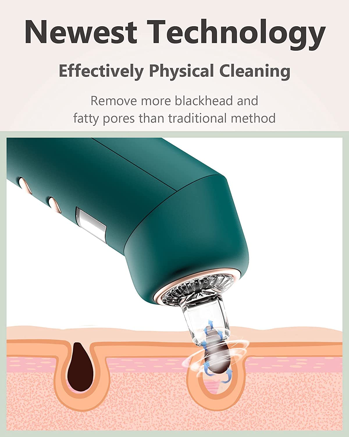 Blackhead Remover Pore Vacuum, Electric Facial Pore Extractor, 5 Suction Tips, Cold Heat Compress