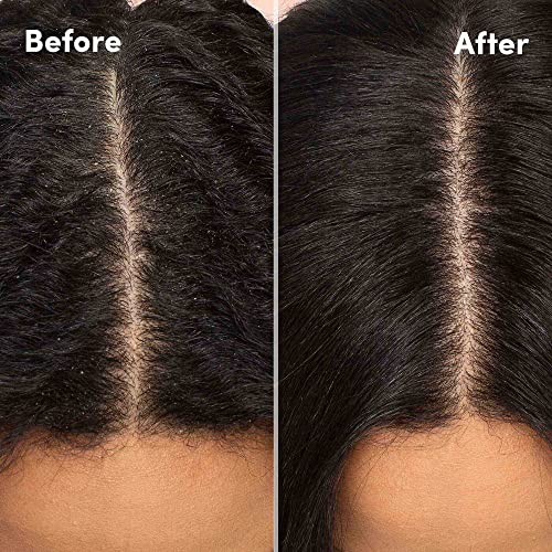 Mizani Scalp Care Dandruff Conditioner | Pyrithione Zinc | Controls Scalp Flaking & Itching | For Curly Hair | 16.9 Fl. Oz