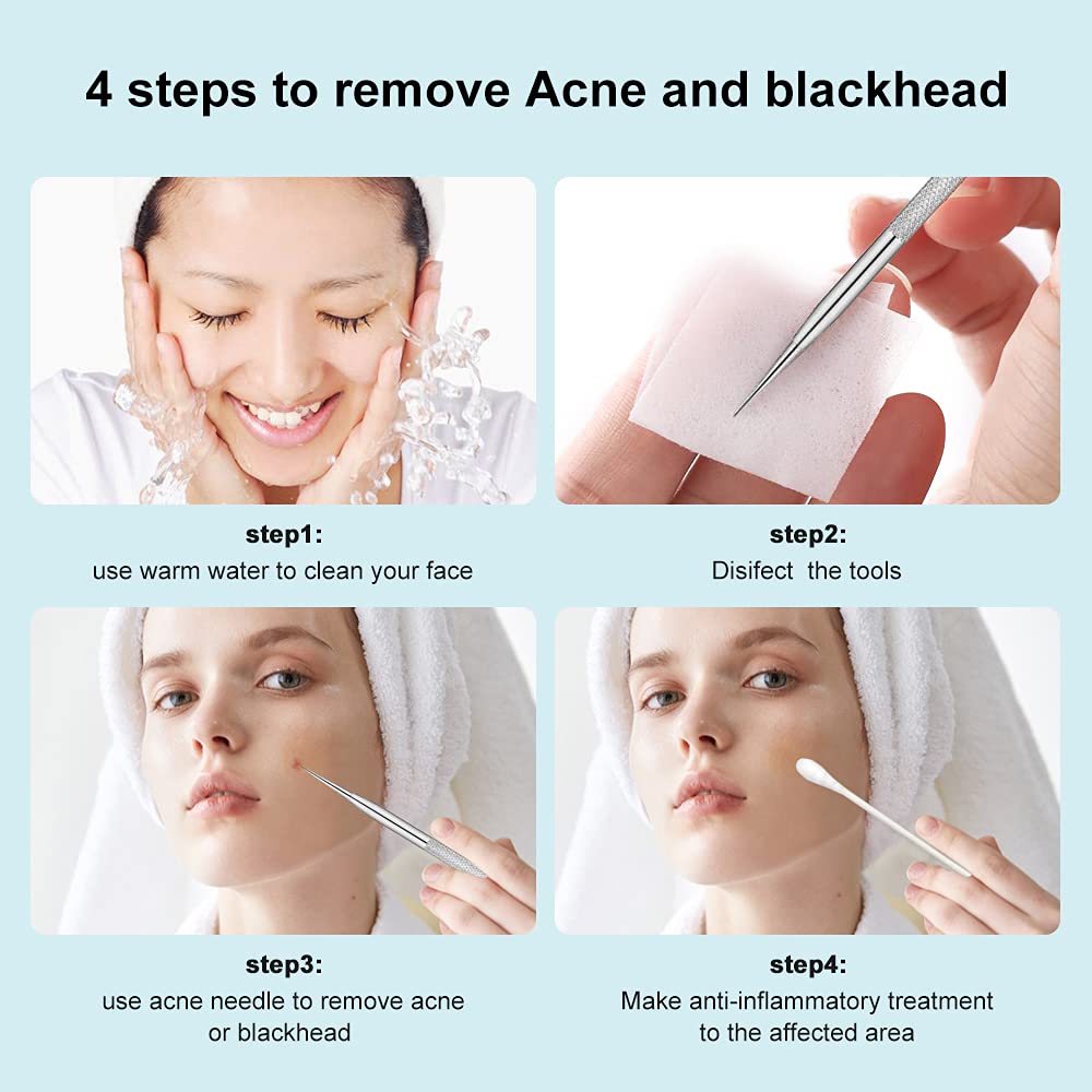 Blackhead Remover, 2 PCS Pimple Popper ,Stainless Steel Pimple Extractor Blackhead Removal Tool Risk Free Treatment for Blemish,Whitehead Popping