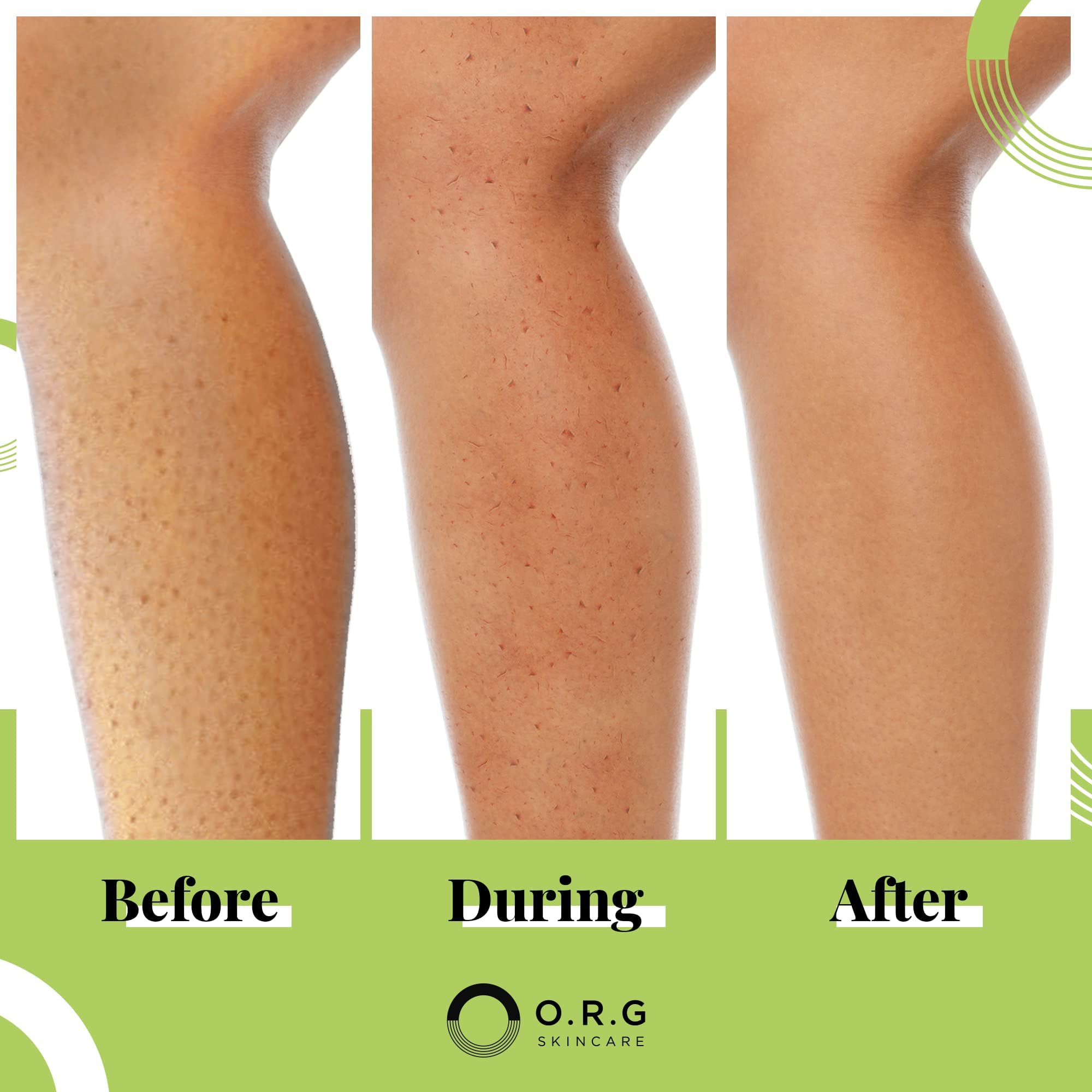ORG Body Scrub Deep Gel Exfoliator for Glowing and Smooth Skin - Korean Exfoliating Peel Skincare - Natural Cruelty Free Formulation for Sensitive Skin 6oz