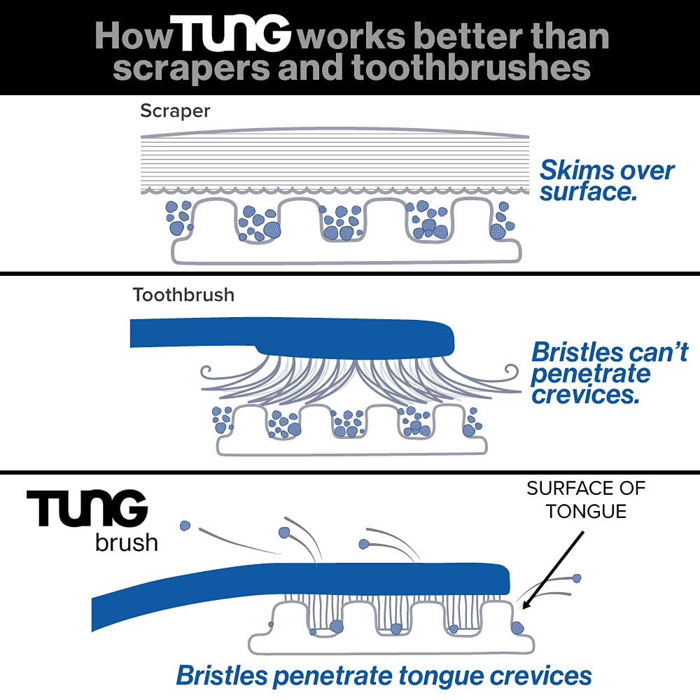 Tung Tongue Gel | Fresh Mint Tongue Cleaning Paste | Bad Breath and Halitosis | Mouth Odor Eliminator | Use with Tongue Brushes & Scrapers | Made in America (2 Pack)