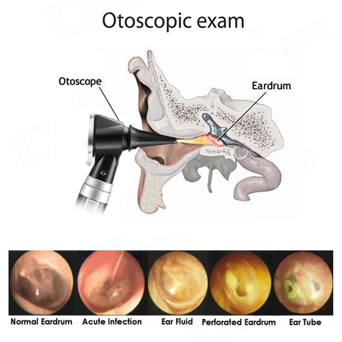 Cross Canada 11-129 Rechargeable Fiber Optic LED Otoscope Diagnostic Set