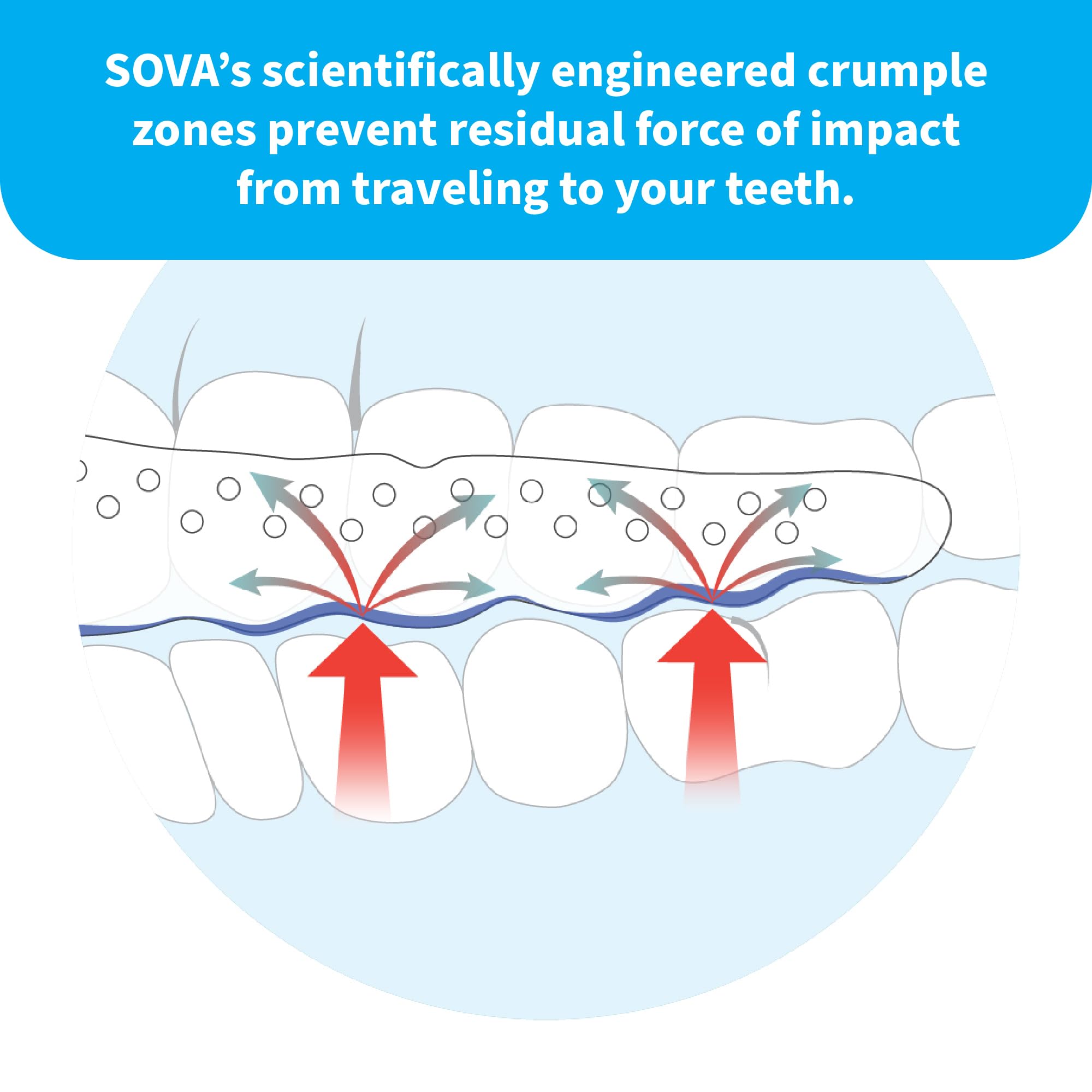 SOVA Aero Night Guard - 1.6mm Thin - Custom-Molded Fit - Protects Against Nighttime Teeth Grinding & Clenching - FSA/HSA Eligible - Odor & Taste Free - Remoldable Up to 20 Times - Non Toxic