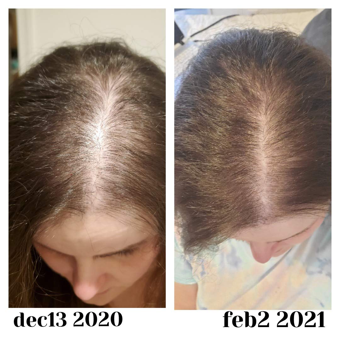 Baby Blues Rest and Restore | Postpartum Hair Loss Vitamins & Sleep Vitamins for Moms