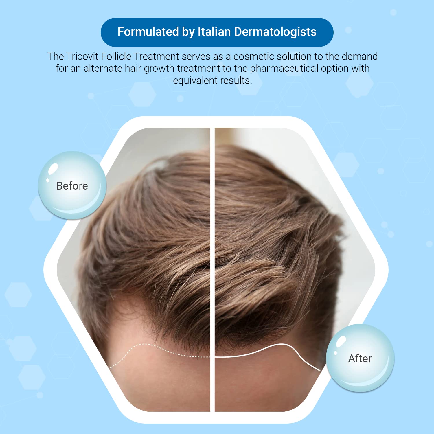 Tricovit Shampoo - Routine Hair Growth Shampoo For Thinning Hair - Promotes Stronger and Thicker Hair With Natural Active Ingredients - 8.4 oz