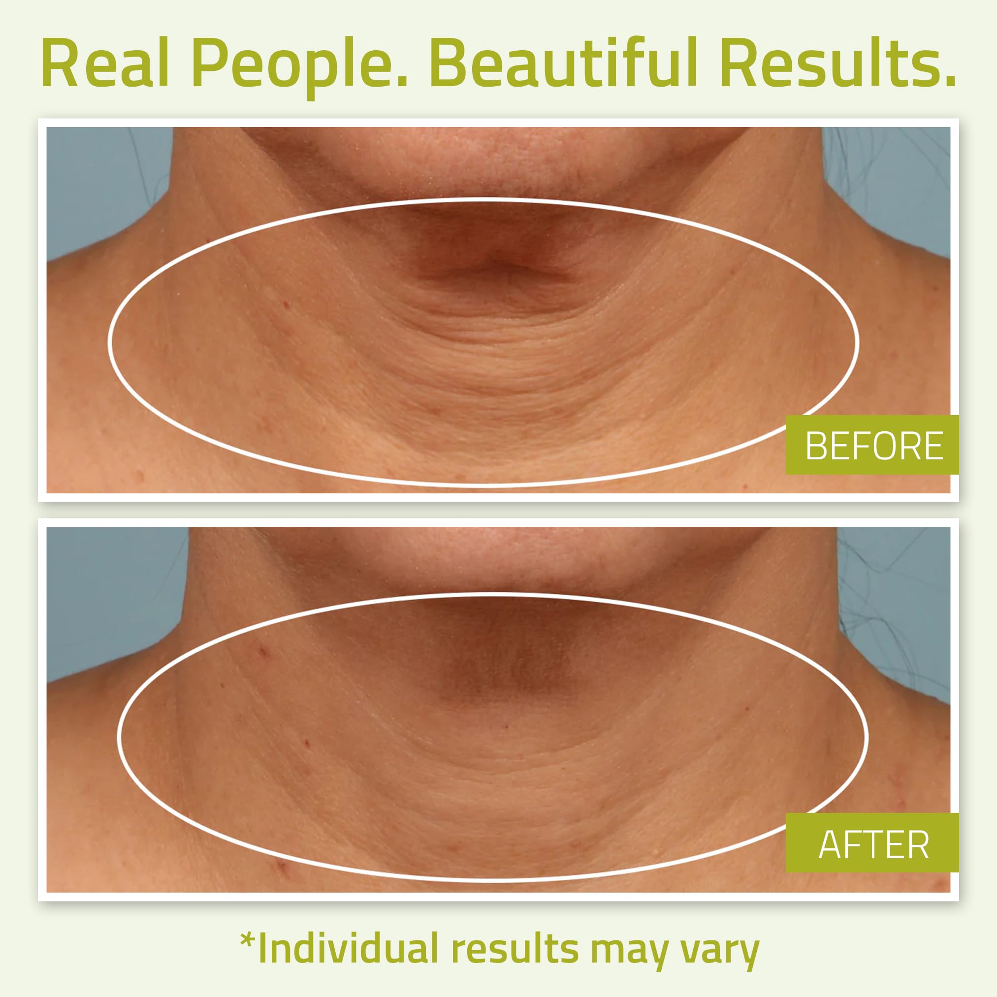 YEOUTH Neck Cream with Vitamin C, Moisturizing Neck Firming Cream for Women and Men, Targeting Decolletage and Double Chin, Cleavage and Chest 2oz