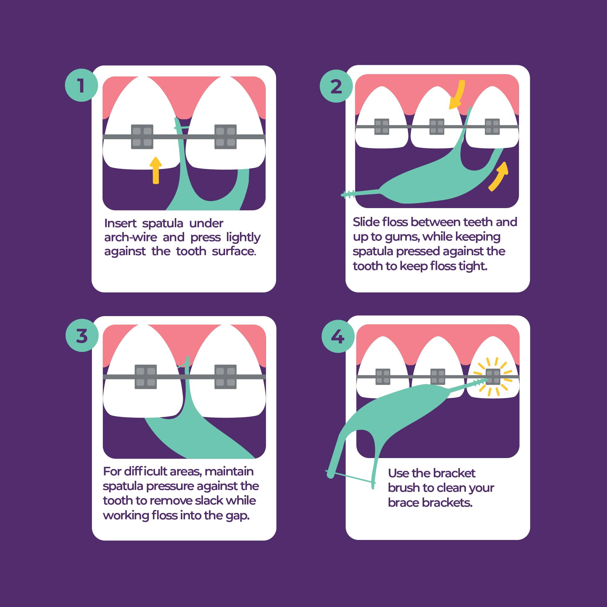Platypus Orthodontic Flossers for Braces Family Pak - Unique Structure Fits Under Arch Wire, Increase Flossing Compliance, Floss Teeth in Less Than Two Minutes - 75 3-Count Flossers (225 Total)