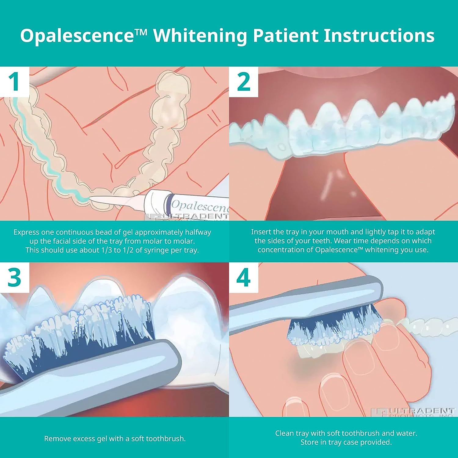 Opalescence 35% Gel Syringes Teeth Whitening - Refill Kit (4 Packs / 8 Count) Carbamide Peroxide. Made by Ultradent, in Cool Mint Flavor. Tooth Whitening Refill Syringes 5197-4