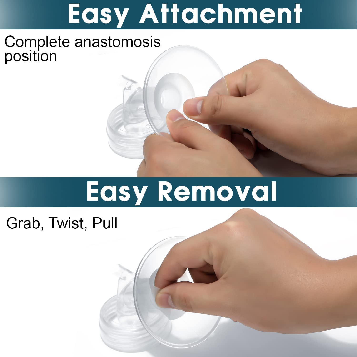 Begical Flange Inserts 18mm for Medela/Spectra/tsrete/momcozy/Elvie/Motif Luna/Ameda MYA Breastpump 24mm Breast Shields. Reduce 24mm Nipple Tunnel Down to 18mm (Half-Clear)