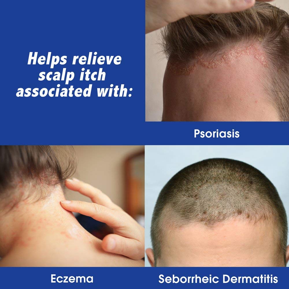 Scalpicin Maximum Strength Scalp Itch Liquid Treatment- For Relief From Itchy Scalp, Psoriasis, Eczema & Seborrheic Dermatitis With Hydrocortisone & Aloe Vera, 1.5 oz (Pack of 2)