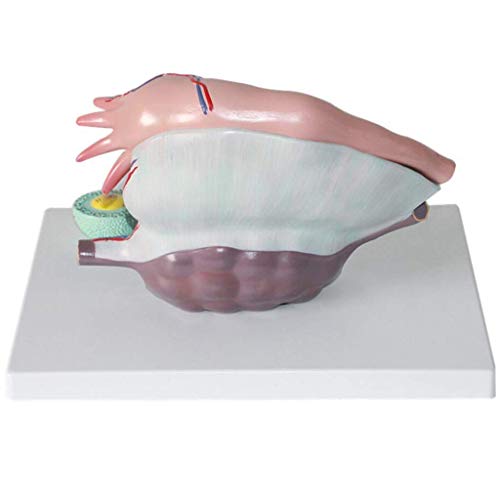 DEAVER Uterine Anatomy Model Ovarian Enlargement Model Skin and Genitourinary System Anatomical Medical Educational Training Aid,Medical Models & Educational Materials