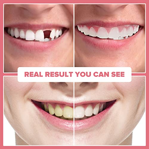 Fake Teeth, 2 PCS Dentures Teeth for Women and Men, Dental Veneers for Temporary Teeth Restoration, Nature and Comfortable to Protect Your Teeth and Regain Confident Smile, Natural Shade
