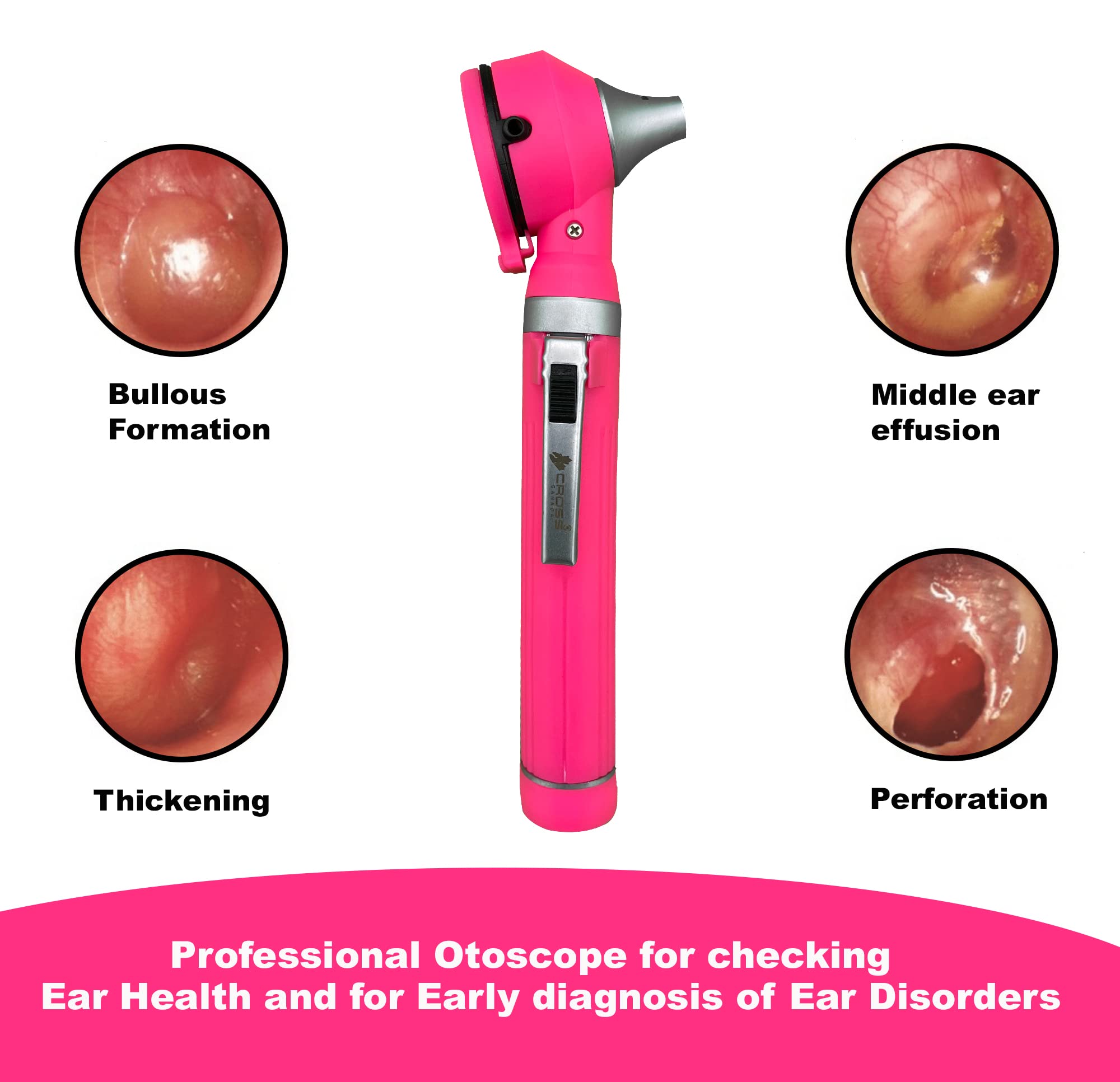 Cross Canada 11-080 Physician Fiber Optic LED Pocket Otoscope Diagnostic Set - Pink