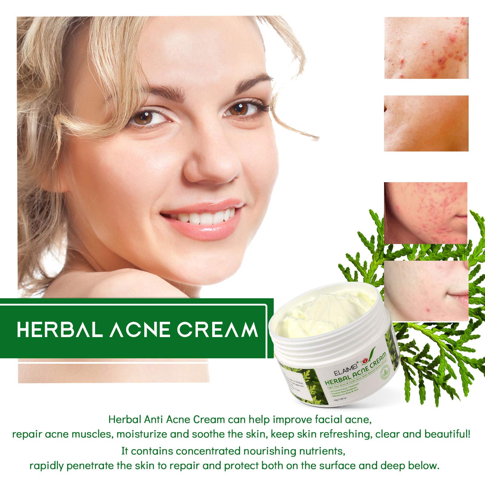 Closed Mouth Improve Herbal Skin Moisturize Personal Skin Care TGw305 (Multicolor, One Size)