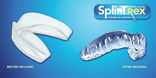 SplinTrex Multi Use Teeth Mouth Guards - 4 Pack - BPA Free - Teeth Grinding Dental Night Guard, Athletic Mouth Guard, Teeth Whitening Tray - Includes 4 Customizable Mouth Guards and Storage Case