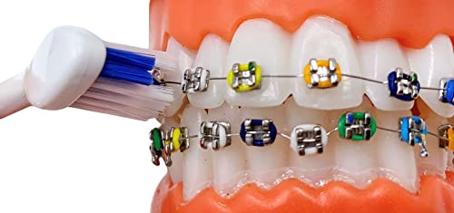 LBailar Braces Toothbrush| Soft Bristle Orthodontic Toothbrush for Cleaning Ortho Braces | U Shaped Portable Toothbrushes for Braces| Set of 4