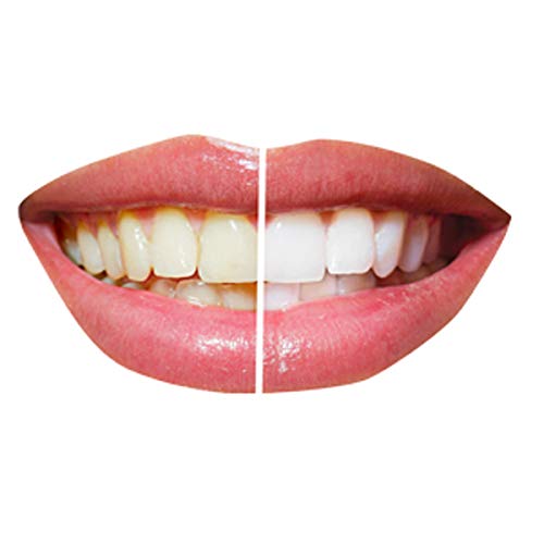 WyFun Replacement Brush Heads for Oral B Electric Toothbrush Precision,Floss, Pro White, Sensitive Gum Care Cross,Sensi,Whitening,16 Count