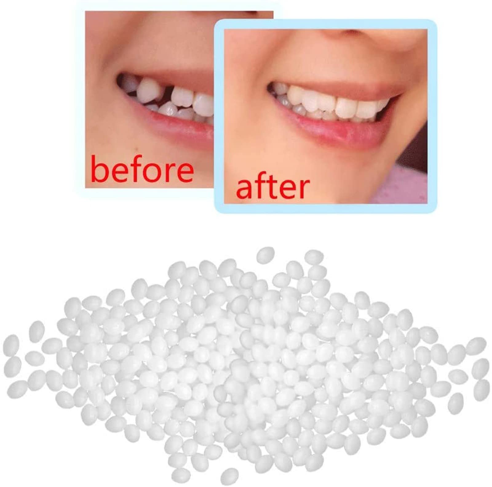Bleach for Teeth For And Solid Tooth Make Glue Denture Teeth (30g) FalseTeeth Temporary Adhesive Confidently Tooth Missing Teeth Gaps Kit Denture Teeth Filler for Gaps