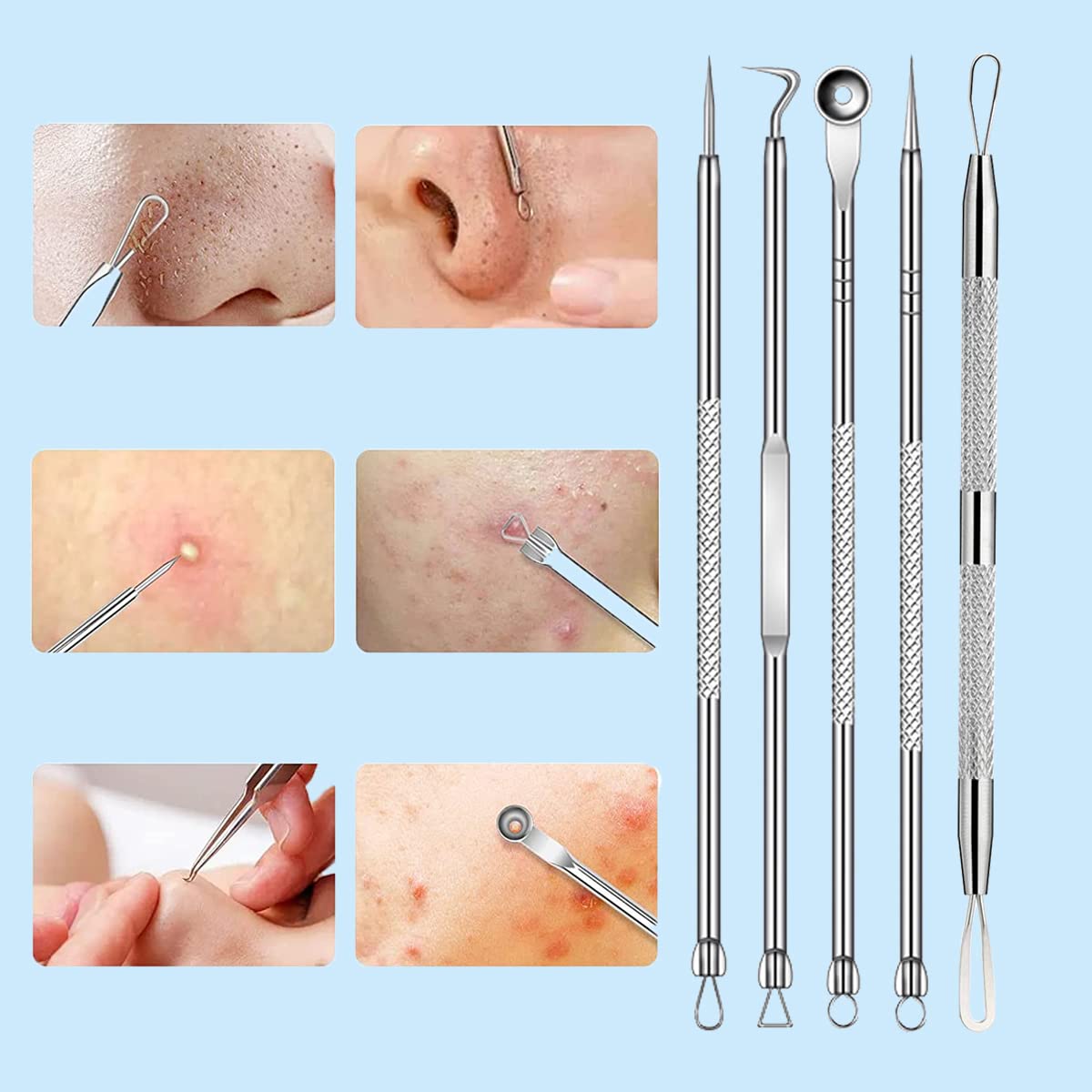 Blackhead Remover Tools - Pack of 8Pcs Silver Pimple Popper Tool Kit, Black Head Extractions Tool, Stainless Steel Acne Blackhead Tools with Portable Metal Case