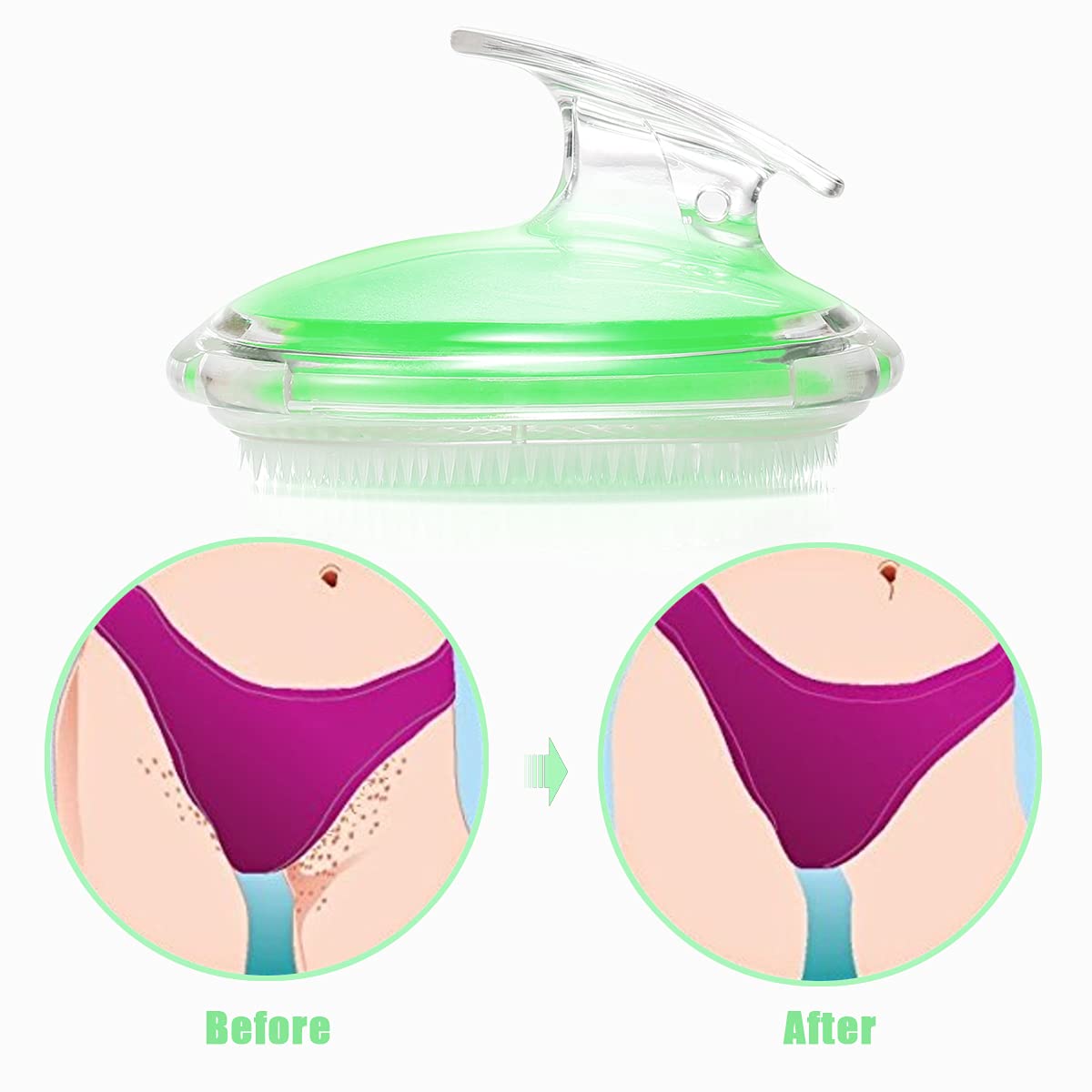 TailaiMei Exfoliating Brush for Ingrown Hair Treatment - To Treat and Prevent Bikini Bumps, Razor Bumps - Silky Smooth Skin Solution for Men and Women