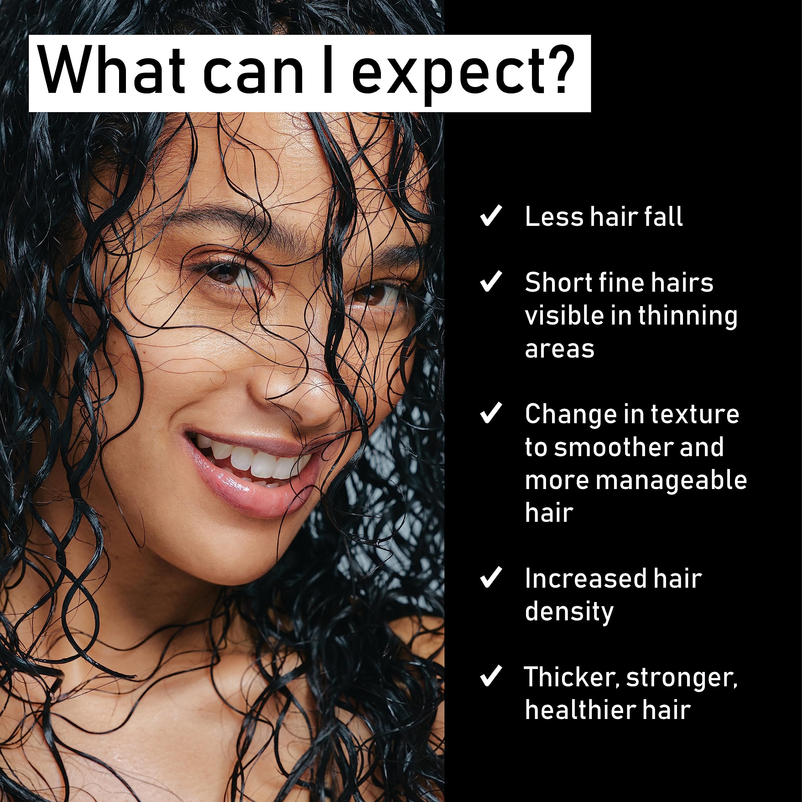 EVOLIS Reverse 3-Step System - Activator, Shampoo & Conditioner - Hair Growth Treatment for Thinning Hair - Keratin Treatment - Accelerates Growth, Thickens and Decreases Hair Fall