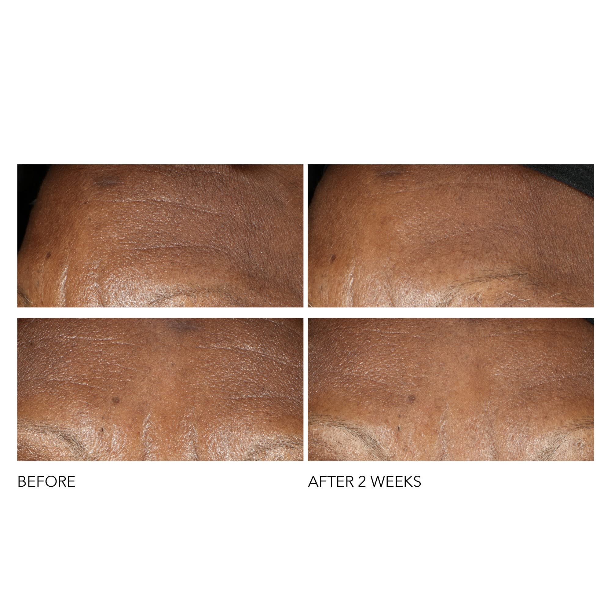 Dr Dennis Gross Advanced Retinol + Ferulic Intense Wrinkle Cream | Intensely Hydrating to Visibly Transform Skin and Repair the Moisture Barrier | 2 oz