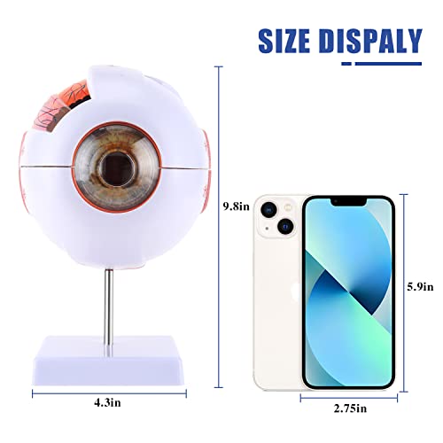 HINGONS 6X Enlarged Human Eye Anatomical Model, Anatomically Eyeball Display Model with Removable Stand for Medical Science Education & Anatomy