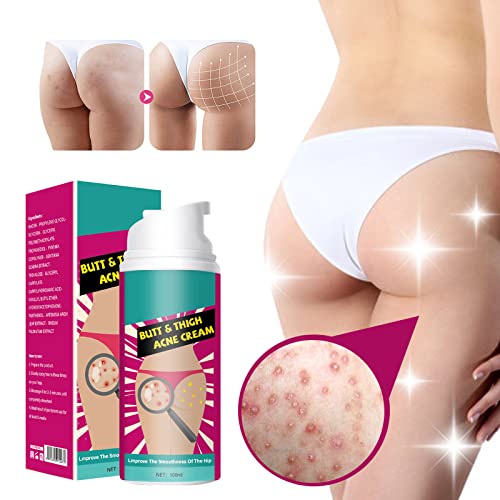 Buttocks And Legs Removal And Printing Tighten Skin Hips Smoothing Moisturizing Face Moisturizer for Oily Skin (White, One Size)
