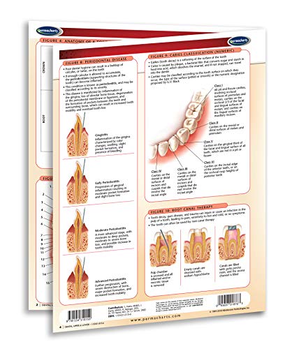 Permacharts Dental Chart - Upper & Lower Quick Reference Guide
